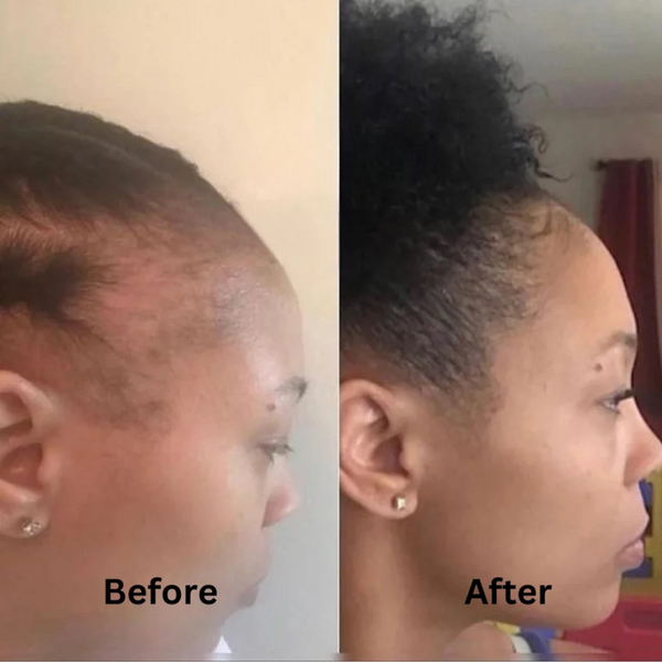 Root Revive Capsules – Lumin US